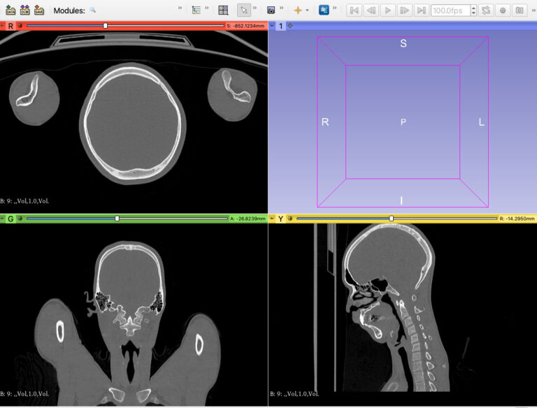 DICOMデータとはなにか｜医療のためのPythonプログラミング
