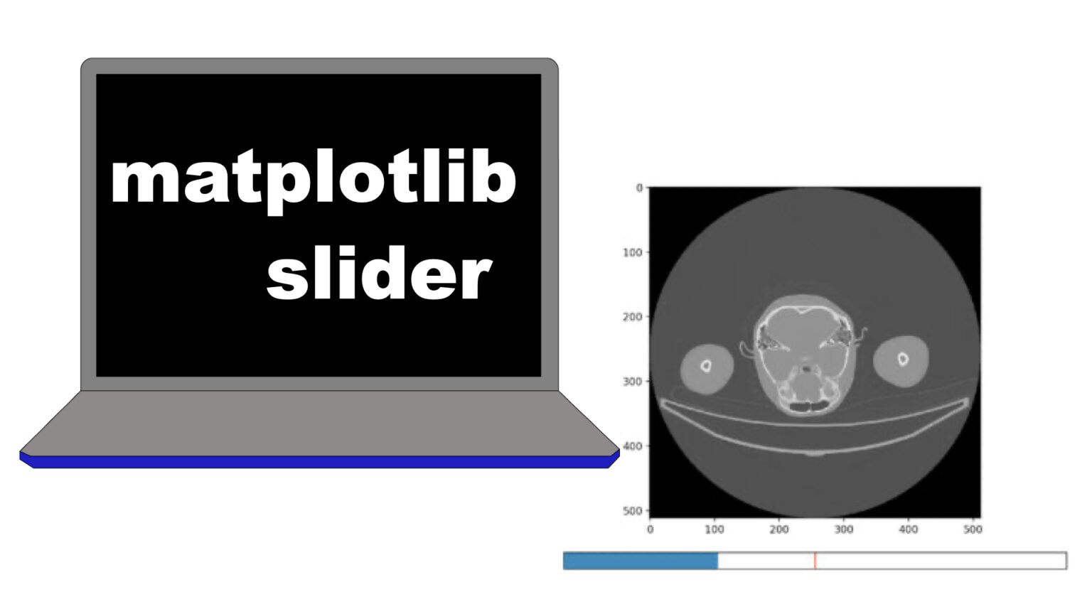 pythonでかんたんなDICOMビューアーの作成 matplotlibのSliderを使う｜医療のためのPythonプログラミング