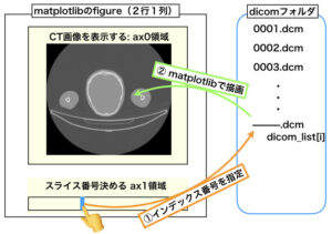 pythonでかんたんなDICOMビューアーの作成 matplotlibのSliderを使う｜医療のためのPythonプログラミング